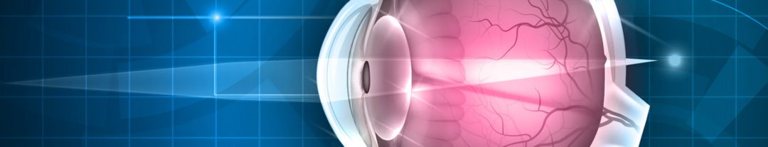 Common Refractive Disorders of the Eye | Brooks Eye Associates