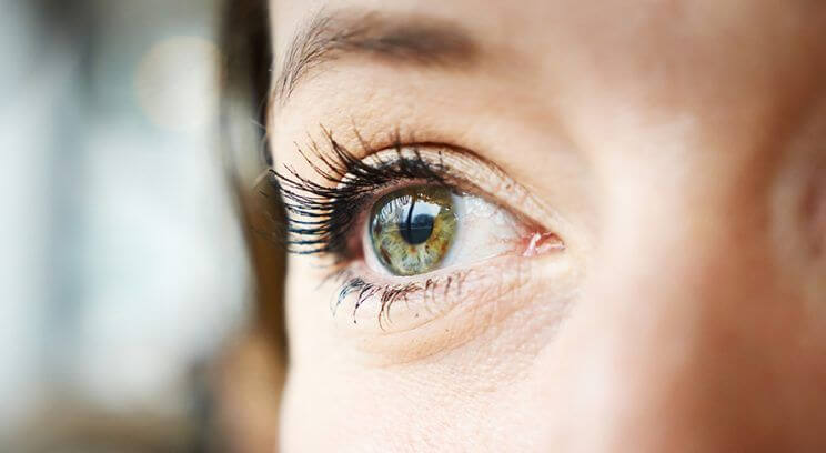 Freckles in the Eye | Eye Center in Plano | Brooks Eye Associates