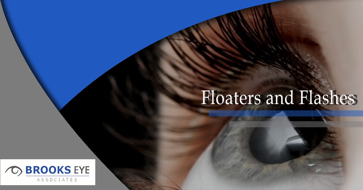 What are Floaters and Flashes? | Brooks Eye Associates
