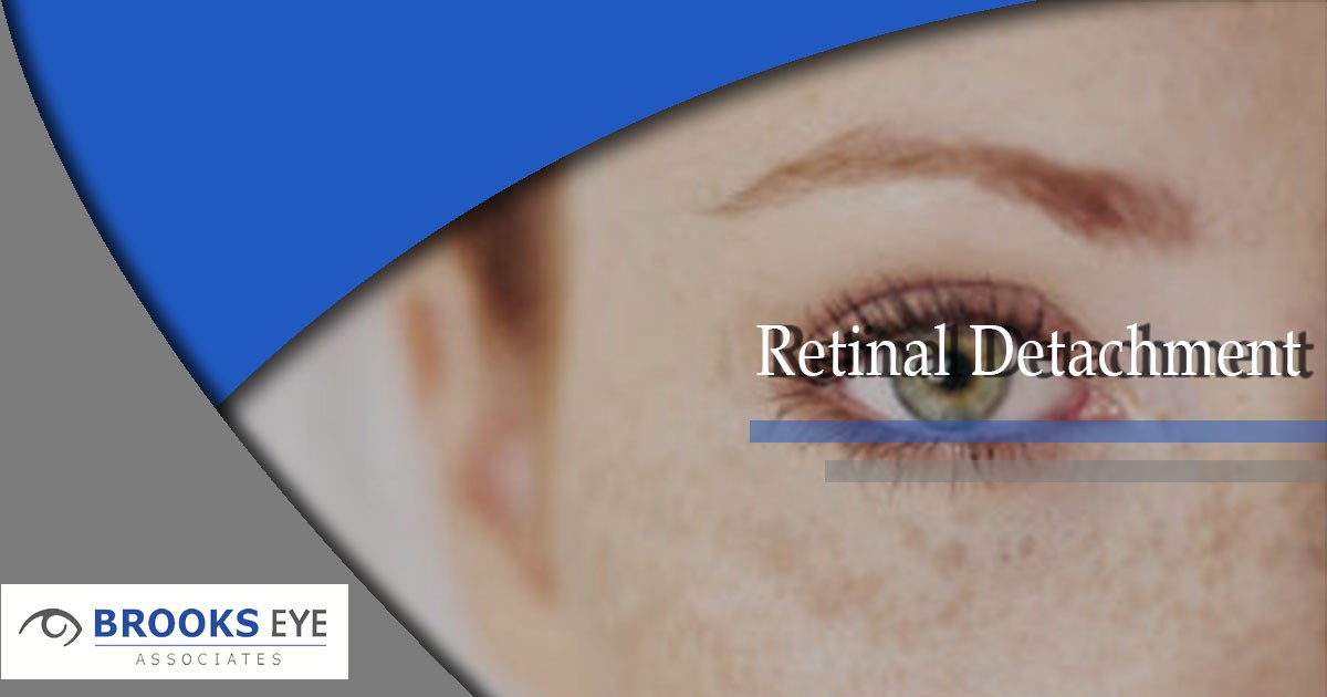 What is Retinal Detachment? | Brooks Eye Associates