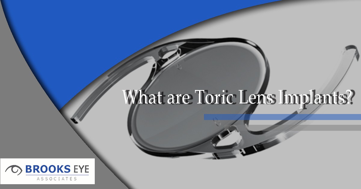 Toric Lens Implants in Plano, TX | Brooks Eye Associates