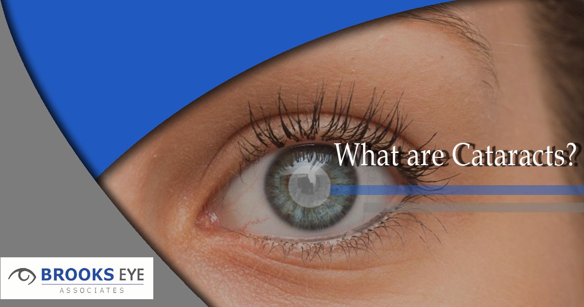 Cataract Eye Surgery In Plano Tx Brooks Eye Associates